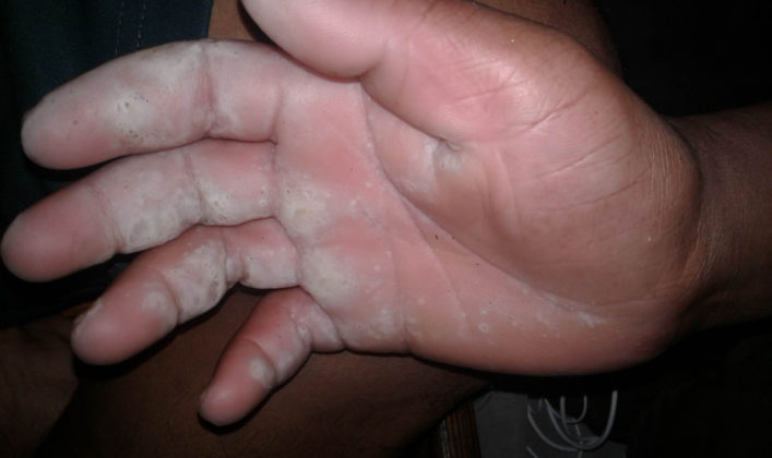 Fisherman kept in ‘abject’ conditions at sea repatriated from Fiji ...